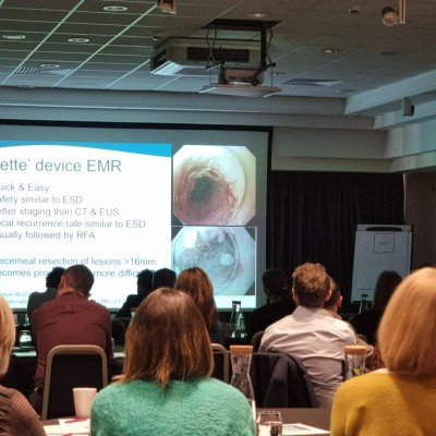 Improving outcomes for people with upper gastrointestinal (upper GI ...